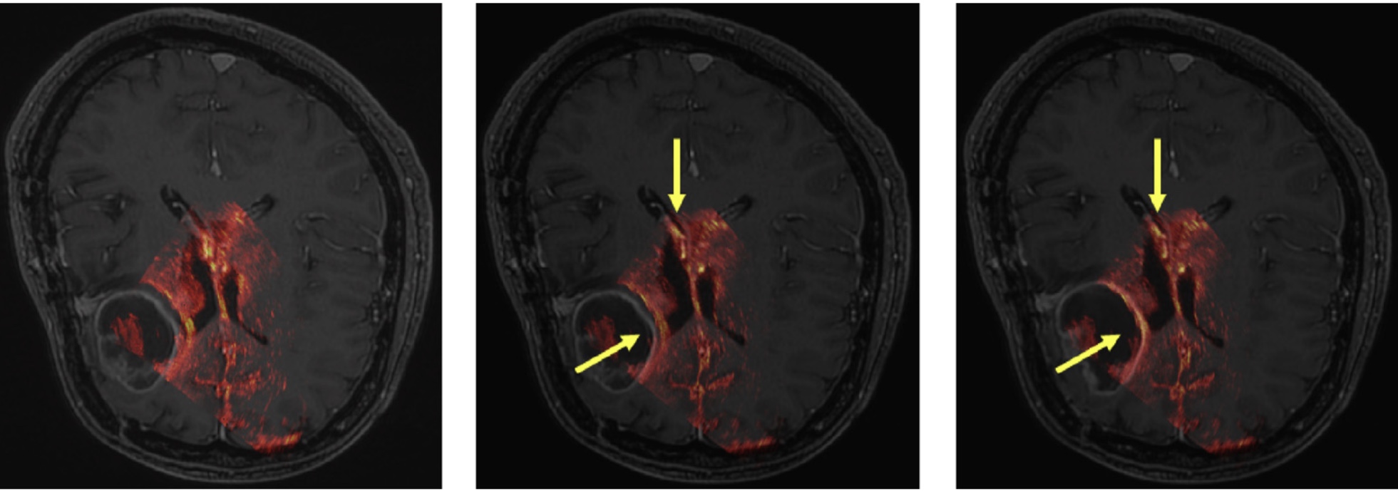 Augmented Reality Assisted Laparoscopic Surgery with Magnetic Resonance ...
