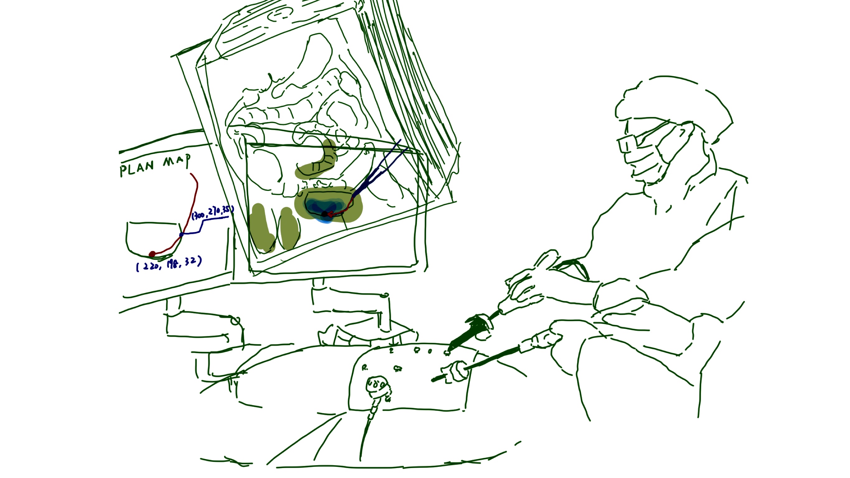 Augmented Reality Assisted Laparoscopic Surgery with Magnetic Resonance ...